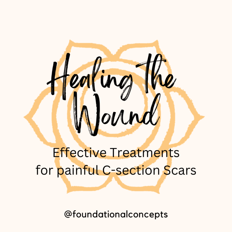 It is all connected, Part 2: The Superficial Back Line